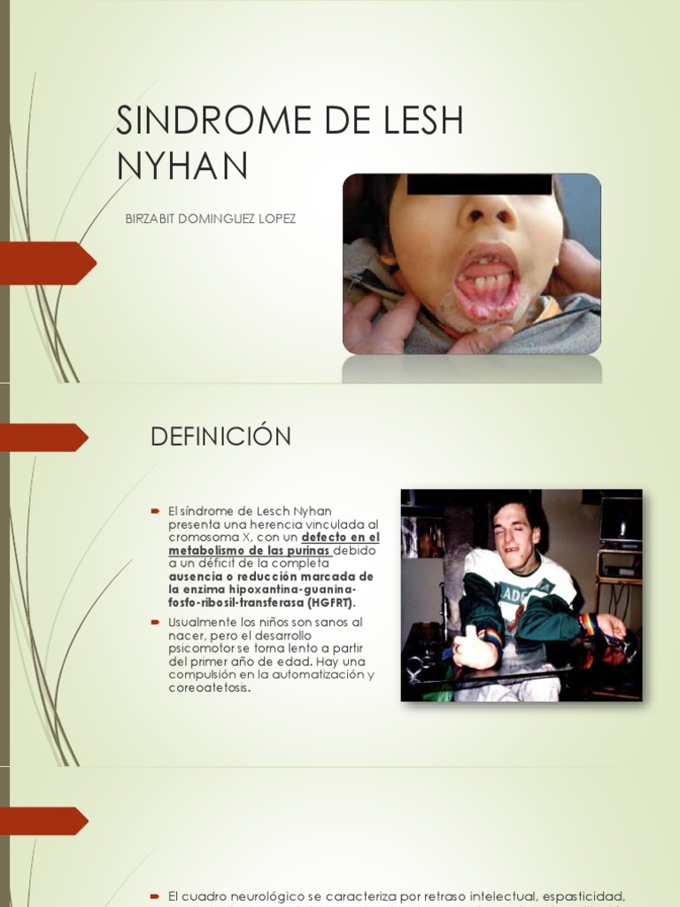 Sindrome de Lesh Nyhan | PDF | Enfermedades y trastornos | Enfermedades ...