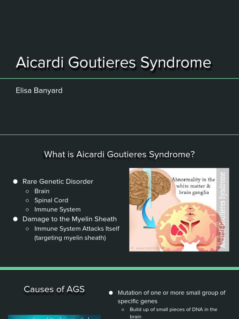 Aicardi Goutieres Syndrome Overview | PDF | Genetic Disorder | Human ...