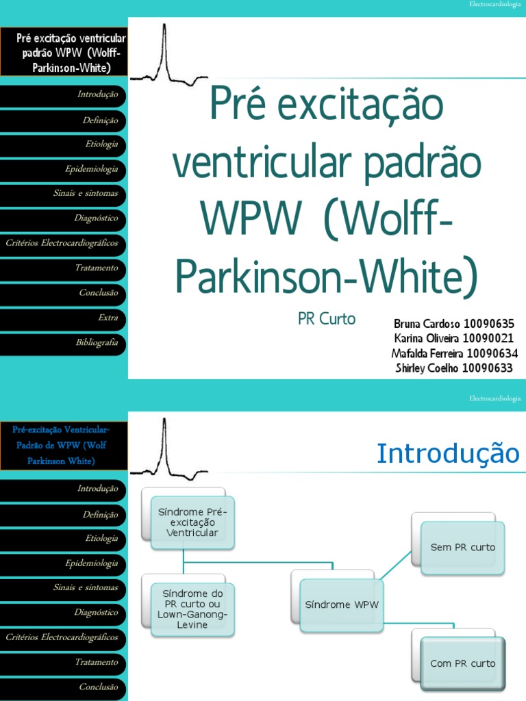WPW Completo - Cópia | PDF | Ventrículo (coração) | Eletrocardiografia