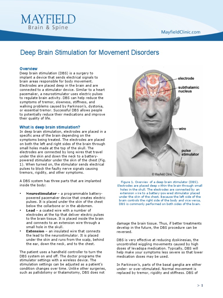 Deep Brain Stimulation For Movement Disorders: Neurostimulator - A ...