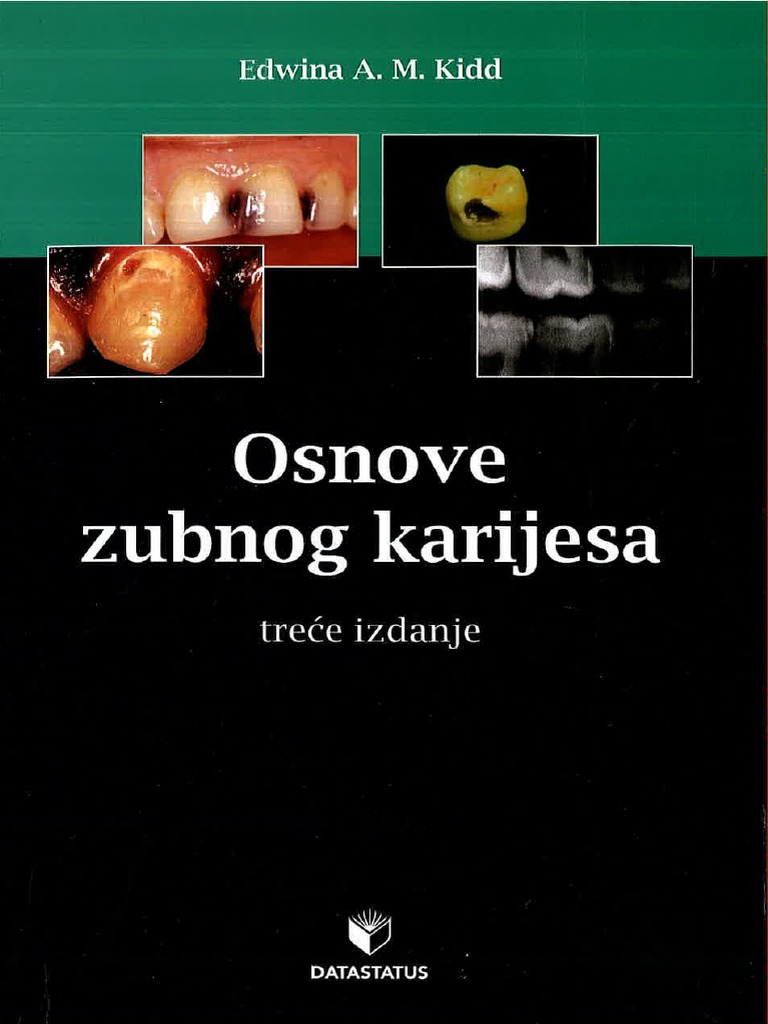 Edwina Kidd - Osnove Zubnog Karijesa PDF | PDF