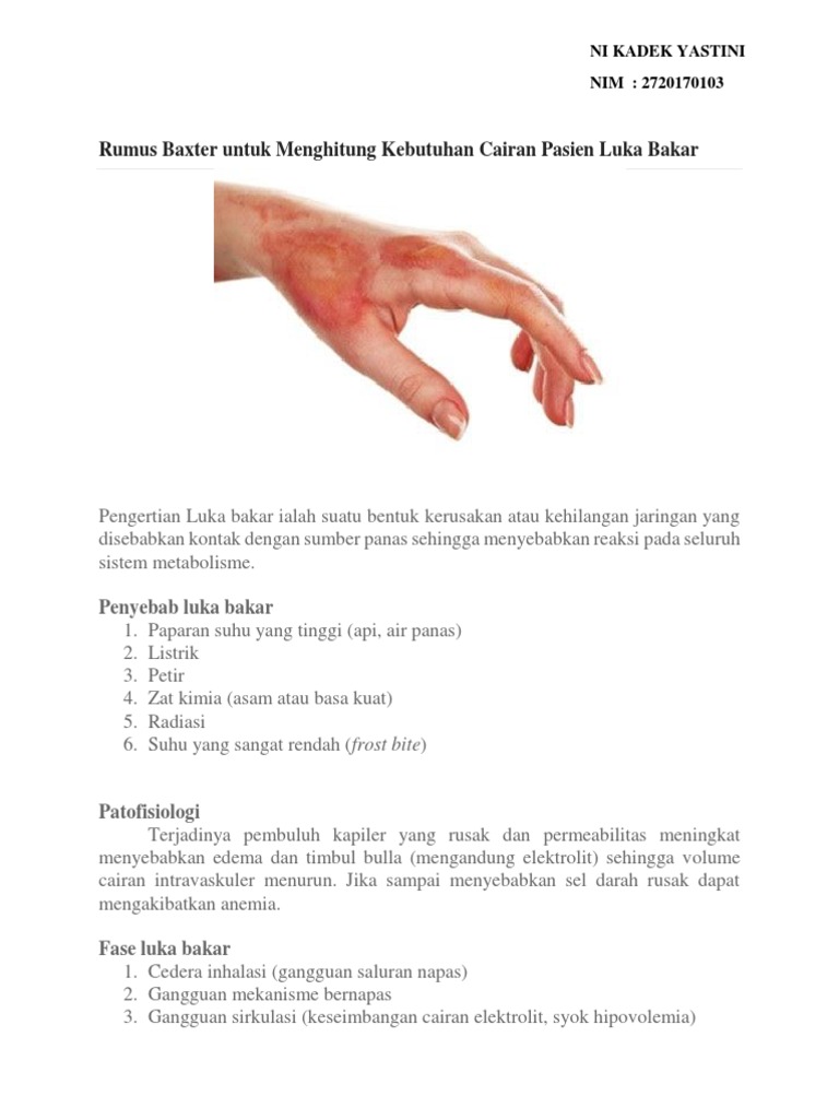Tugas Rumus Baxter Untuk Menghitung Kebutuhan Cairan Pasien Luka Bakar | PDF