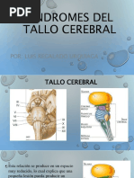 Sindromes Alternos Del Tallo | PDF | Desórdenes neurológicos ...