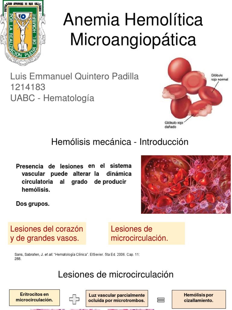 Anemia Hemolítica Microangiopática | PDF | Escherichia coli | Fluidos ...