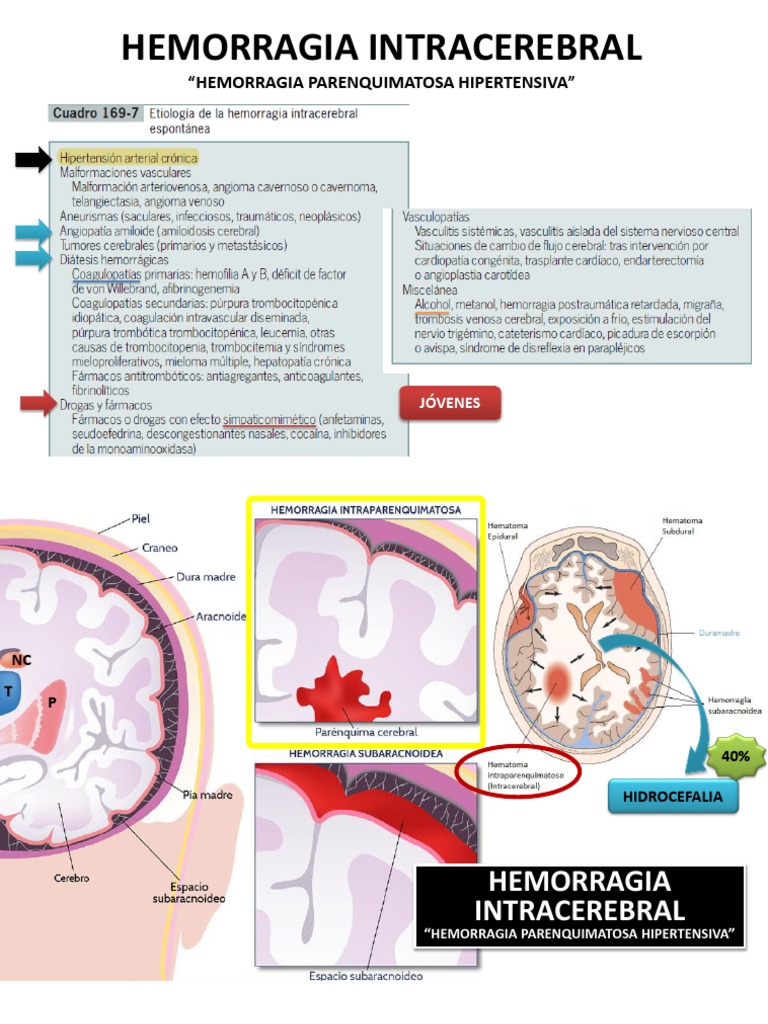 Que Es Hemorragia Intracerebral – KKSURC