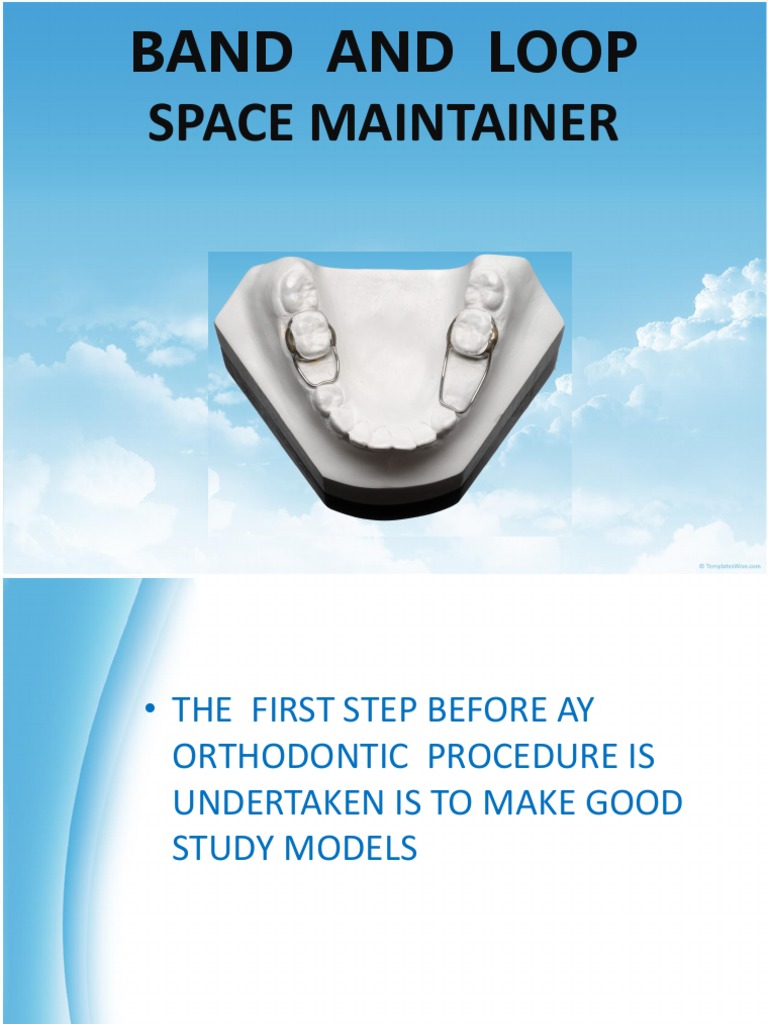 Band and Loop | PDF | Soldering | Solder