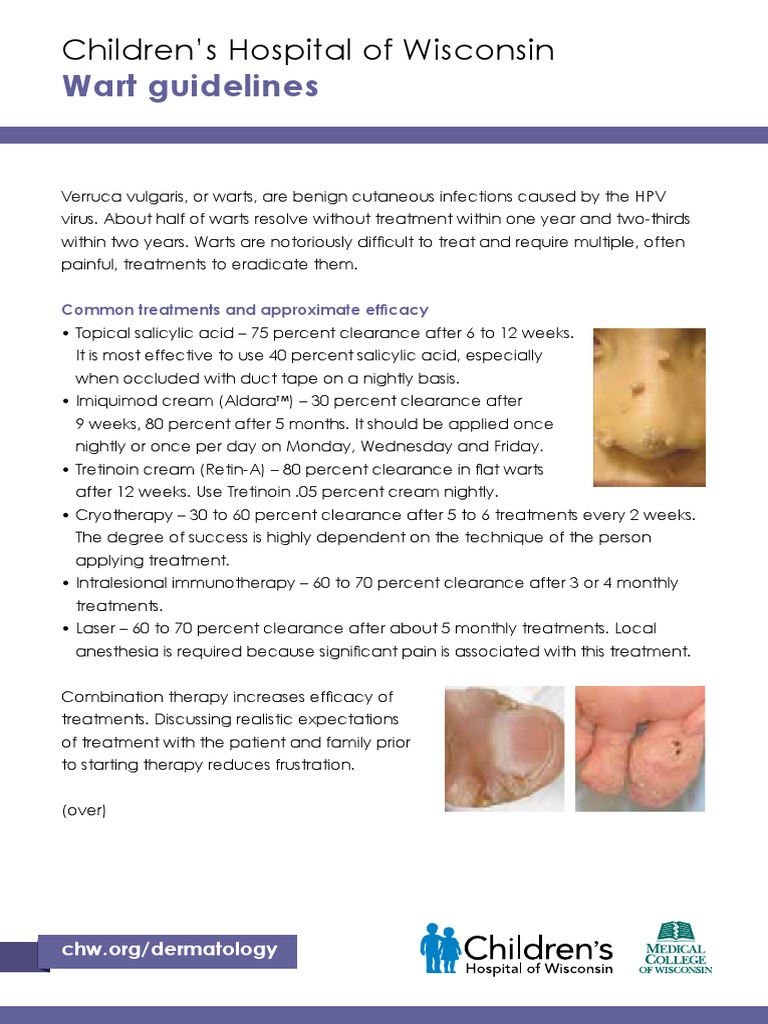 Wart Guidelines: Children's Hospital of Wisconsin | PDF | Diseases And ...