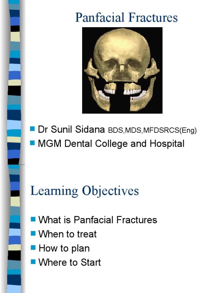 Management of Panfacial Fractures | PDF | Face | Skeletal System