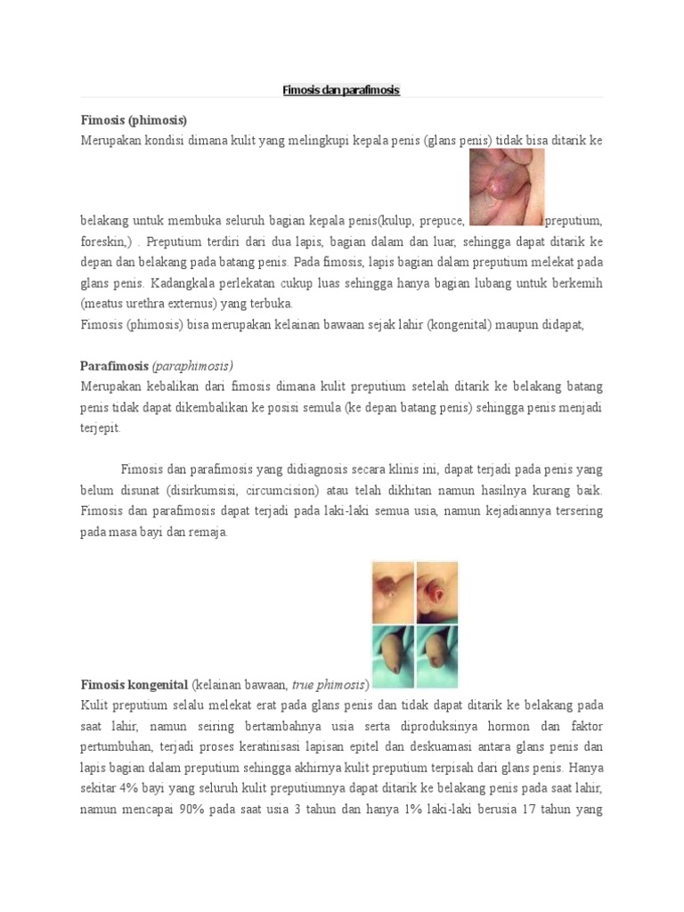 Fimosis dan Parafimosis: Penyebab dan Solusi | PDF