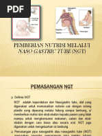 NGT (Naso Gastric Tube) DEWASA DAN ANAK | PDF