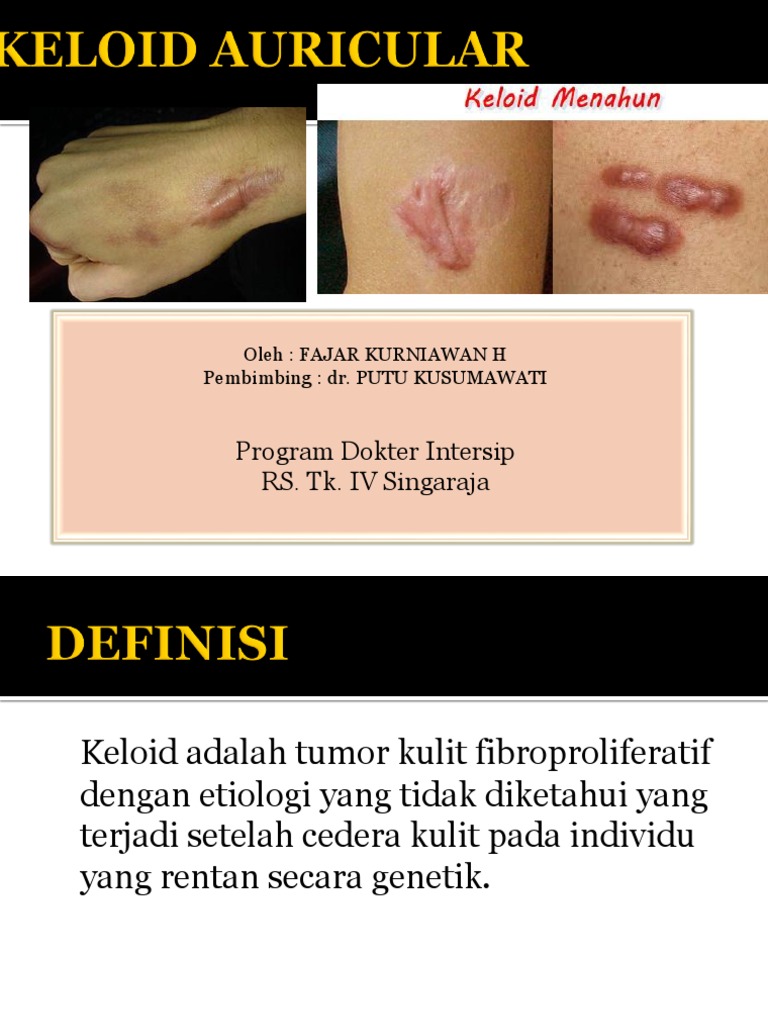 Lapsus 1 Keloid | PDF | Pengembangan Diri | Kesehatan Holistik