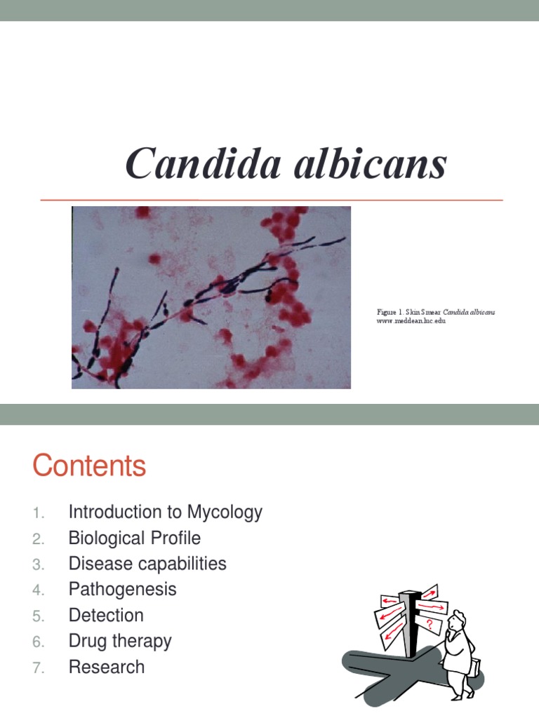 Candida Albicans: Figure 1. Skin Smear Candida Albicans WWW - Meddean ...
