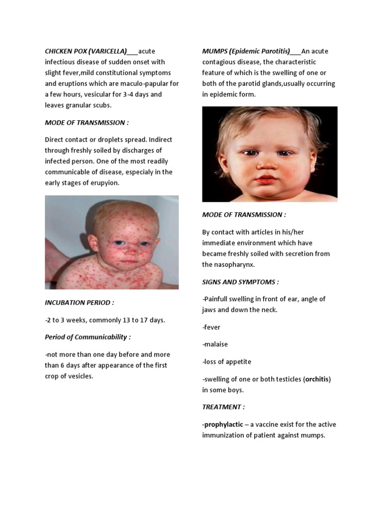 Chicken Pox (Varicella) - Acute MUMPS (Epidemic Parotitis) - An Acute ...