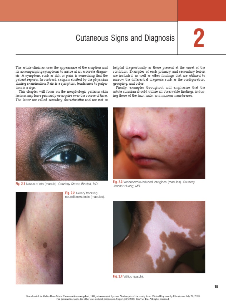 Cutaneous Signs and Diagnosis | PDF | Cutaneous Conditions | Diseases ...