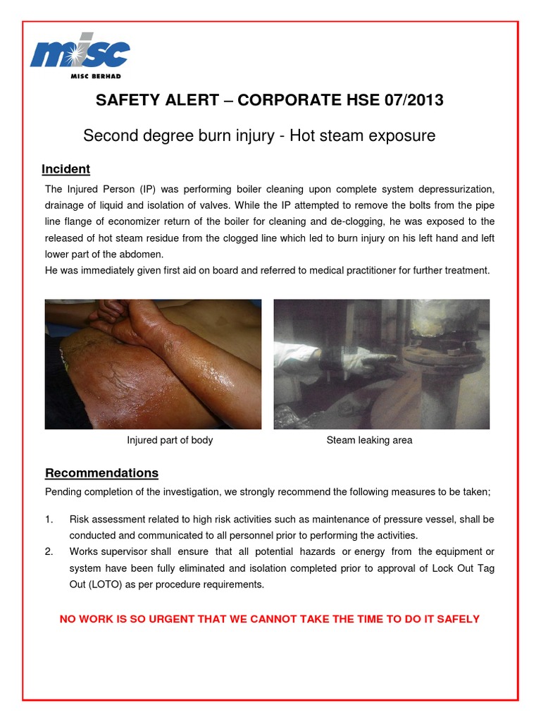 7.CHSE Alert 07 2013 (Second Degree Burn Injury - Hot Steam Exposure) | PDF