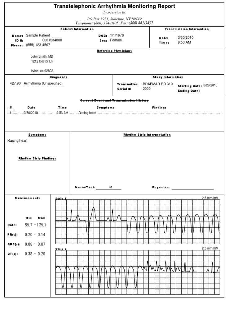 Arrhythmia TTM Report | PDF | Cardiovascular System | Health Care