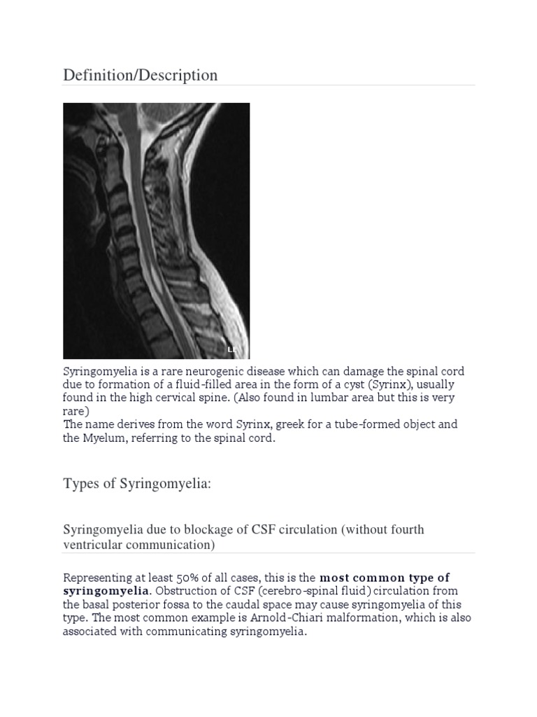 Definition/Description: Types of Syringomyelia | PDF | Nervous System ...