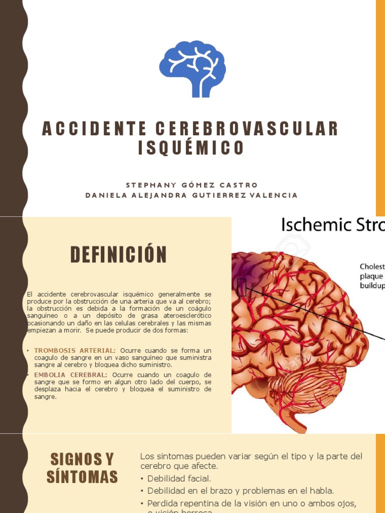 Acv Isquemico | PDF | Carrera | Isquemia