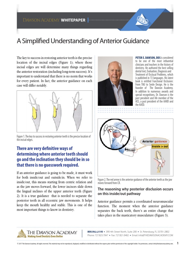 A Simplified Understanding of Anterior Guidance | PDF | Dentistry ...