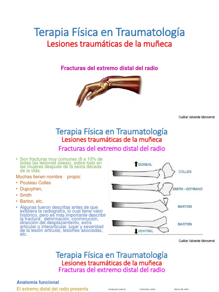Lesiones Traumáticas de La Muñeca | Traumatologia | Hueso
