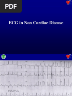 12-Lead EKG Interpretation | PDF