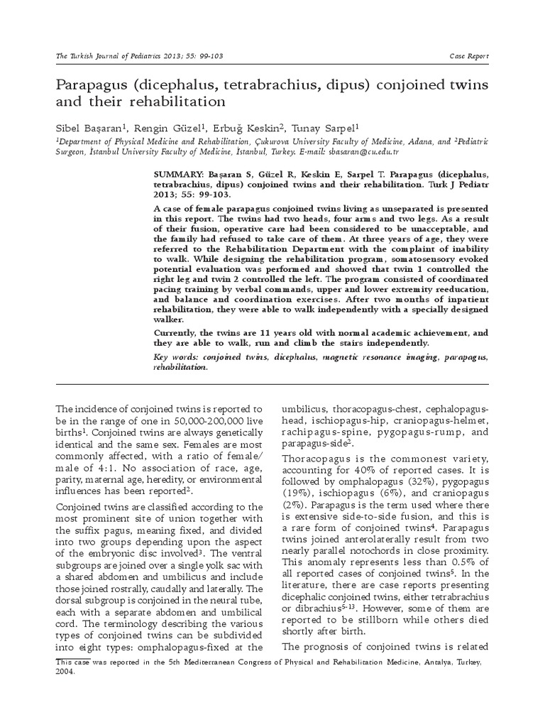 Conjoined Twins - Parapagus (Dicephalus, Tetrabrachius, Dipus) | PDF ...