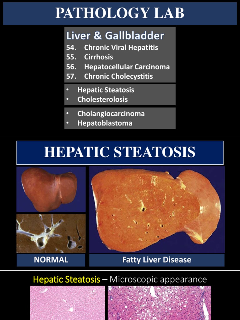 Pathology Lab 54 - Liver & Gallbladder | PDF