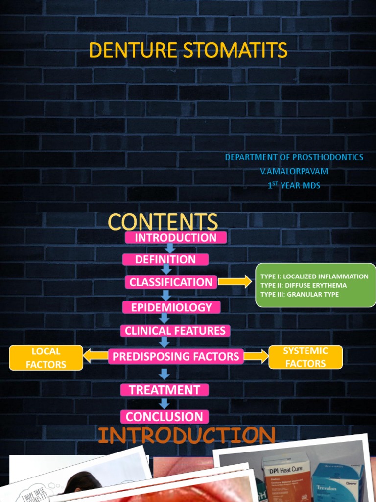 Denture Stomatitis | Candidiasis | Dentures