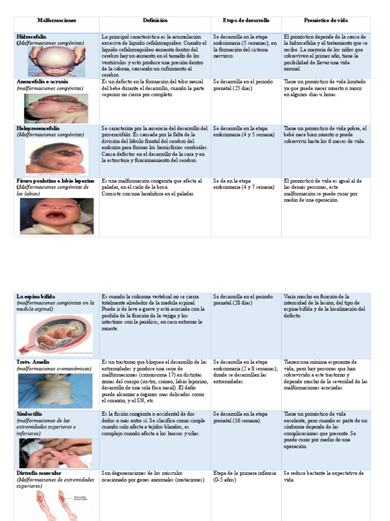 Malformaciones | PDF | Pediatría | Desorden congenito
