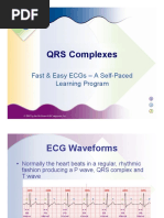 ECG - EKG Practice Quiz (Identify Rhythms) | PDF | Electrocardiography ...