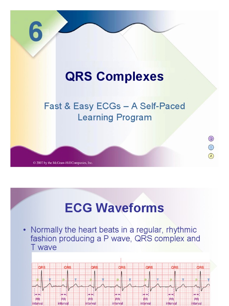 Qrs Complexes: Fast & Easy Ecgs - A Self-Paced Learning Program ...