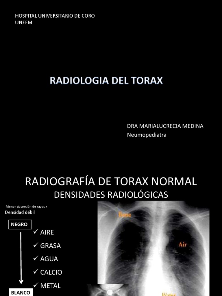 RX Normal y Patrones RX | PDF | Pulmón | Tórax