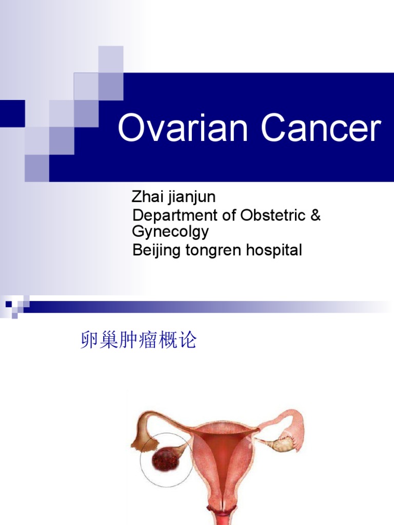 Comprehensive Overview of Ovarian Cancer: Classification ...