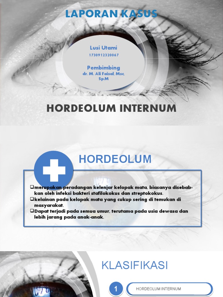 HORDEOLUM INTERNUM Presentation | PDF