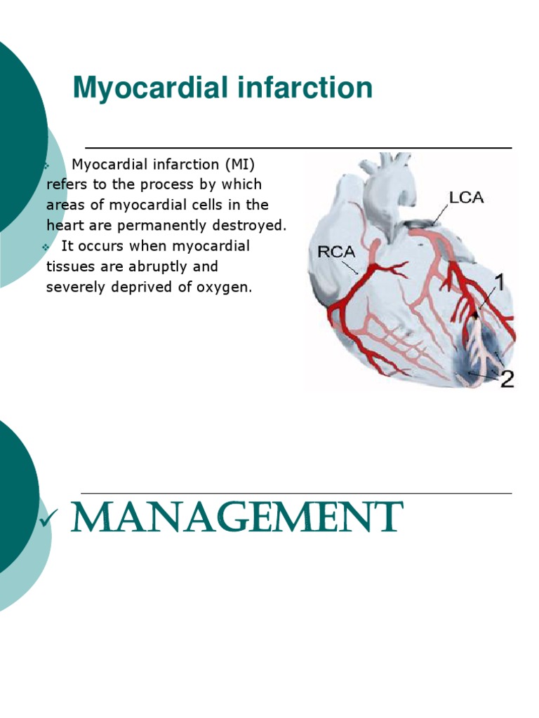 Myocardial infarction | Percutaneous Coronary Intervention | Myocardial ...