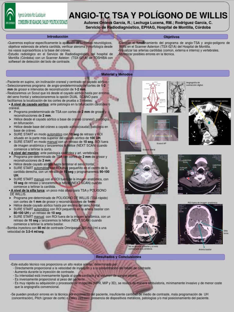 Poster_722_angio Tac Tsa y Poligono de Willis | Angiografía | Medicina ...