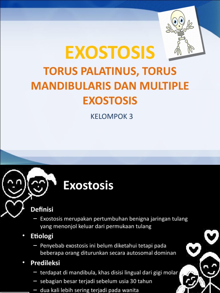 Exostosis | PDF