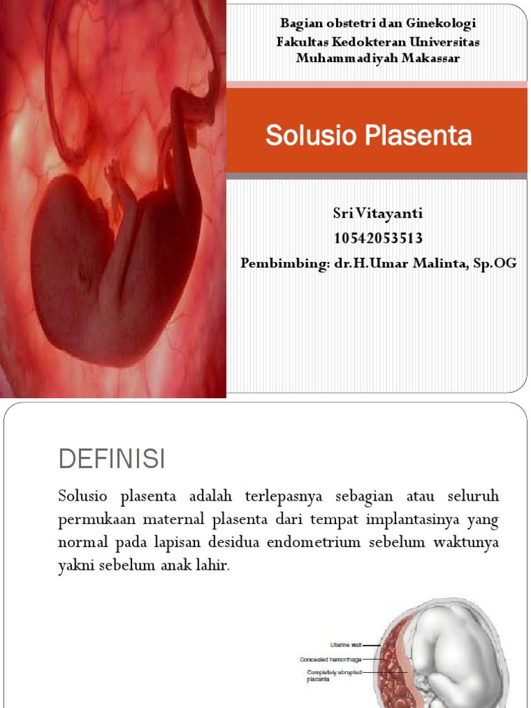 Solusio Plasenta | PDF