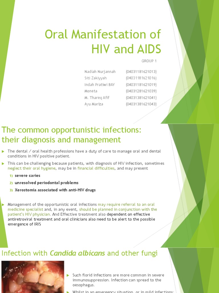 Oral Manifestation of Hiv And Aids | Candidiasis | Public Health