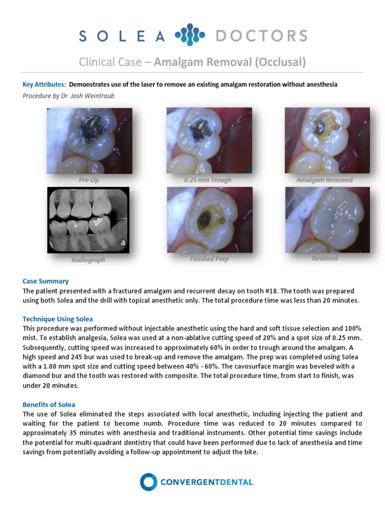 Amalgam Removal Decay | PDF