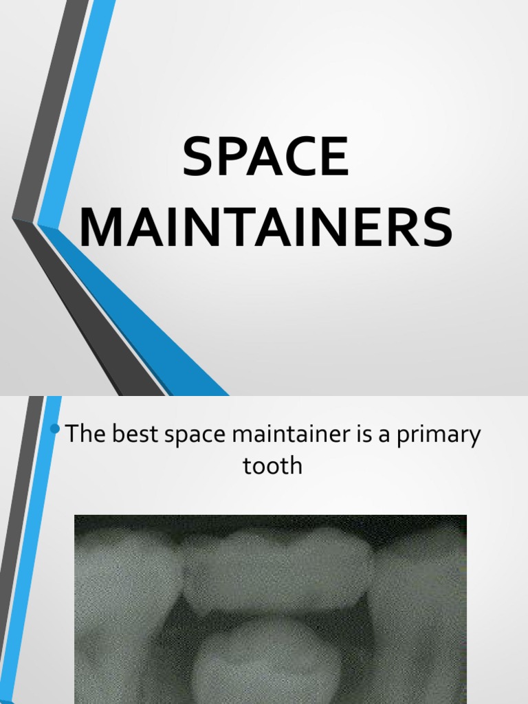 Space Maintainer | PDF | Orthodontics | Human Tooth