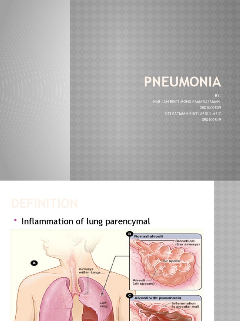 Pneumonia Ppt