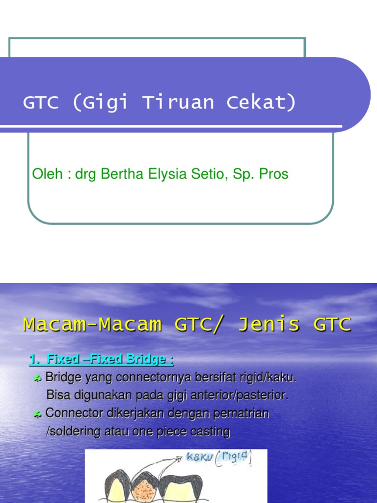 Jenis dan Kegagalan Gigi Tiruan Cekat | PDF