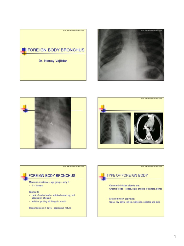 Foreign Body Oesophagus and Bronchus | PDF | Pulmonology | Clinical ...