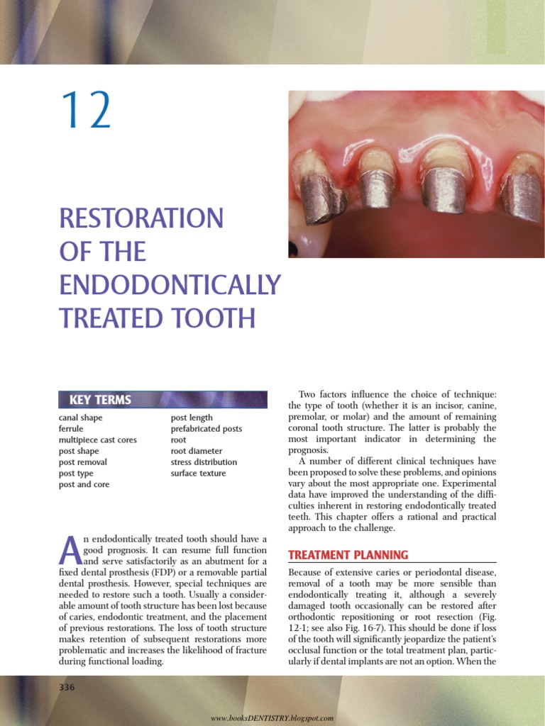 12 RESTORATION OF THE ENDODONTICALLY TREATED TOOTHmic PDF | PDF | Tooth ...