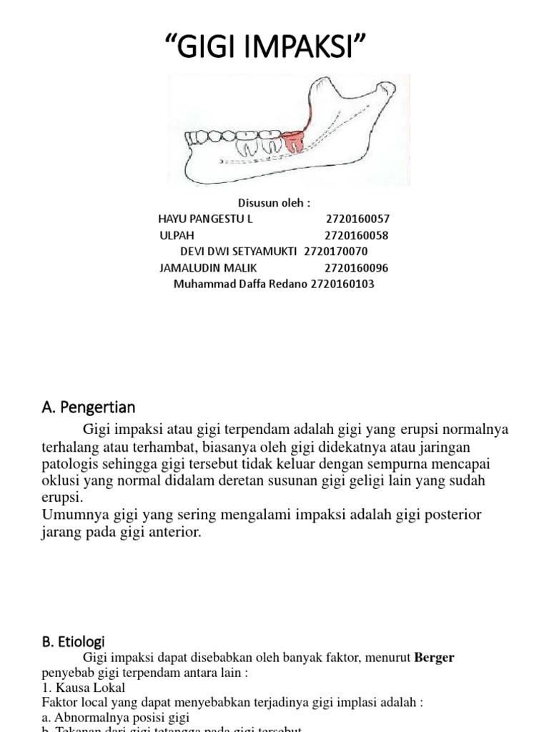 Gigi Impaksi | PDF