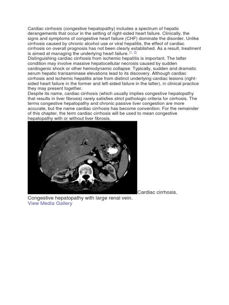 Cardiac Cirrhosis. Congestive Hepatopathy With Large Renal Vein | PDF ...