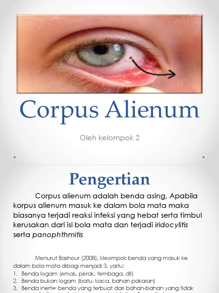 Corpus Alienum | PDF