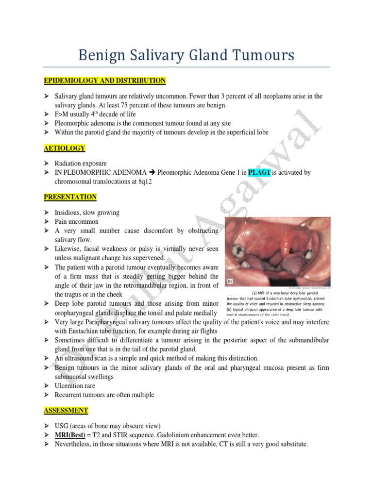 Benign Salivary Gland Tumours | PDF | Adenoma | Neoplasms