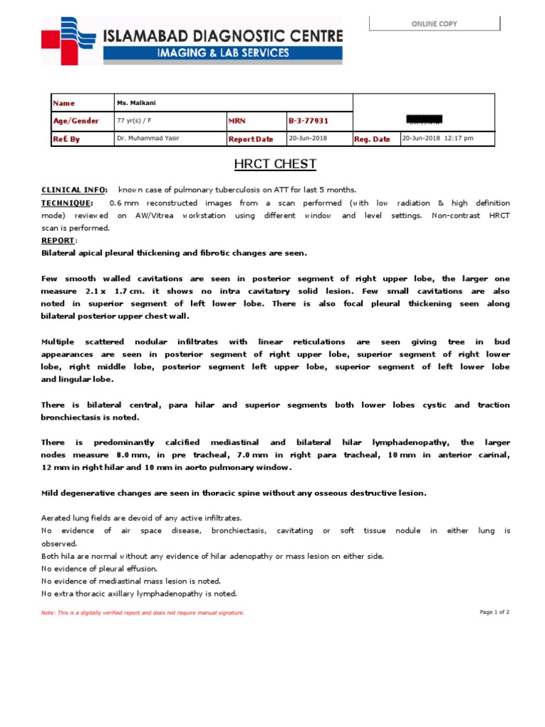 HRCT Chest: Name Age/Gender Ref. by MRN Report Date B-3-77931 Reg. Date ...